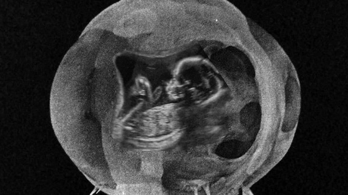 The Law of Being: Existence Under Entropy