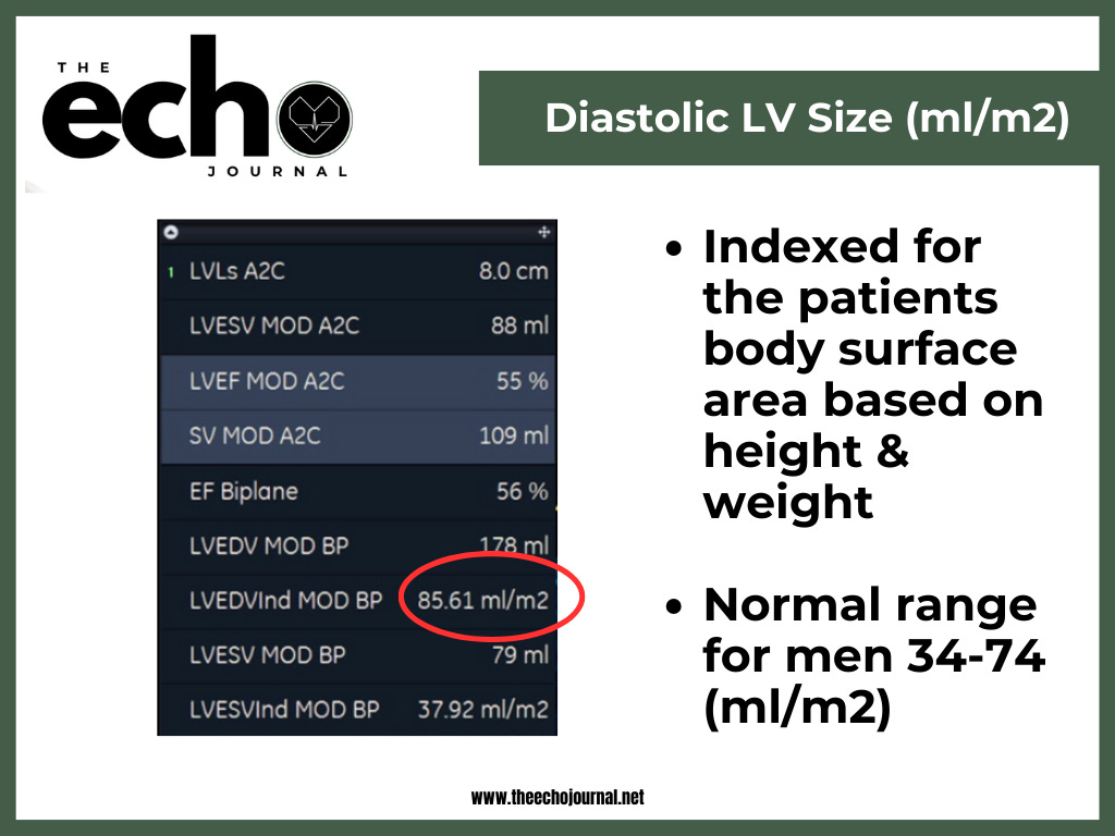 Premature Ventricular Contractions: The Hidden Echocardiography Trap