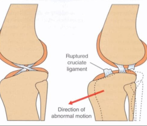 Diagnosing and Treating Cranial Cruciate Ligament (ACL) Injuries in Dogs