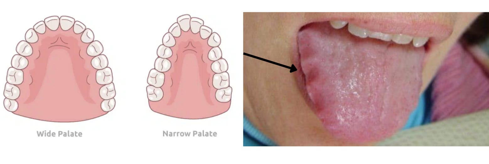 Beauty + Health Part 1: The Maxilla