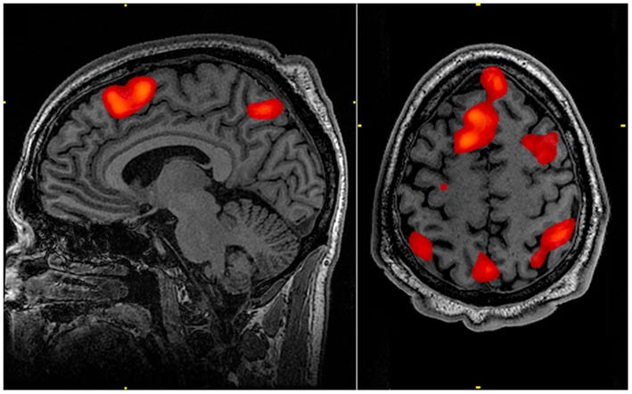 How fMRI actually works - neuroscience, explained