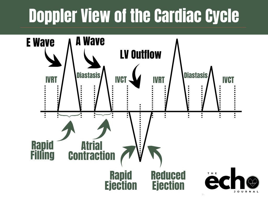 Understanding the Wiggers Diagram - by Alex C.