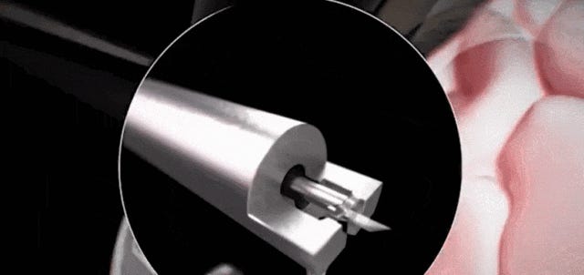 Musk’s Neuralink Breakthrough: 10,000 Queue for Brain Implant