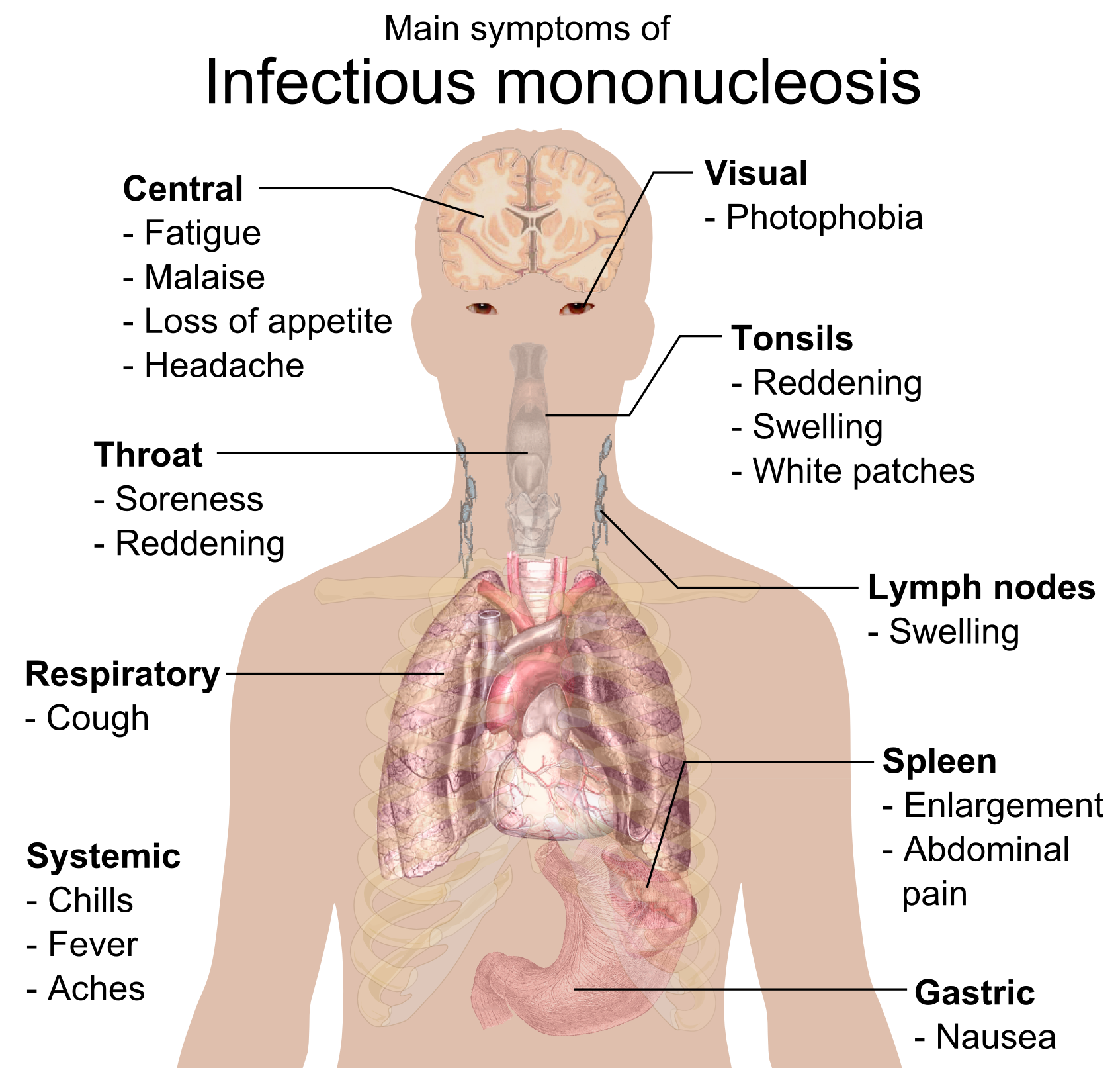Treating mono: will it become a reality?