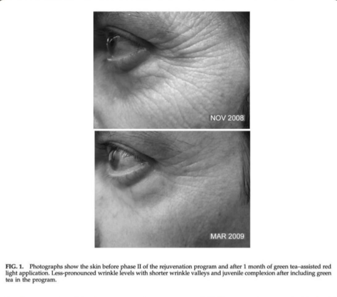 Achieve 10 months worth of anti-aging results in just 1 month: Science ...