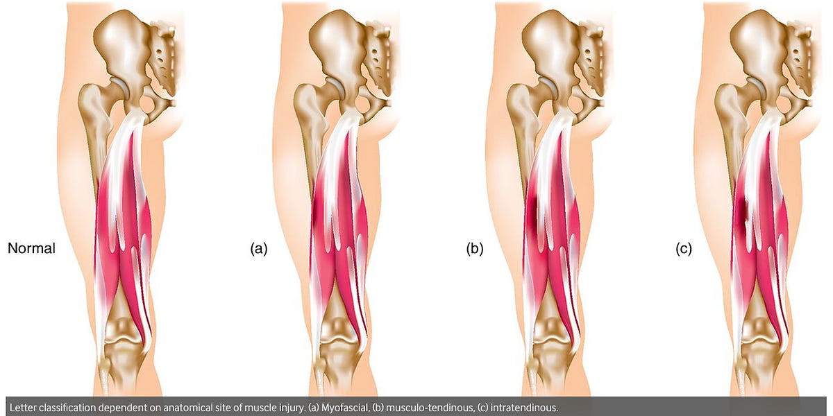 Out with the old, in with the new: A more detailed, functional grading ...