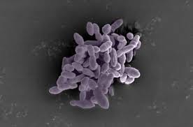 Contra Skolnick On Schizophrenia Microbes