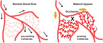 Natural Bypasses: The Body’s Secret Defense Against Blocked Arteries