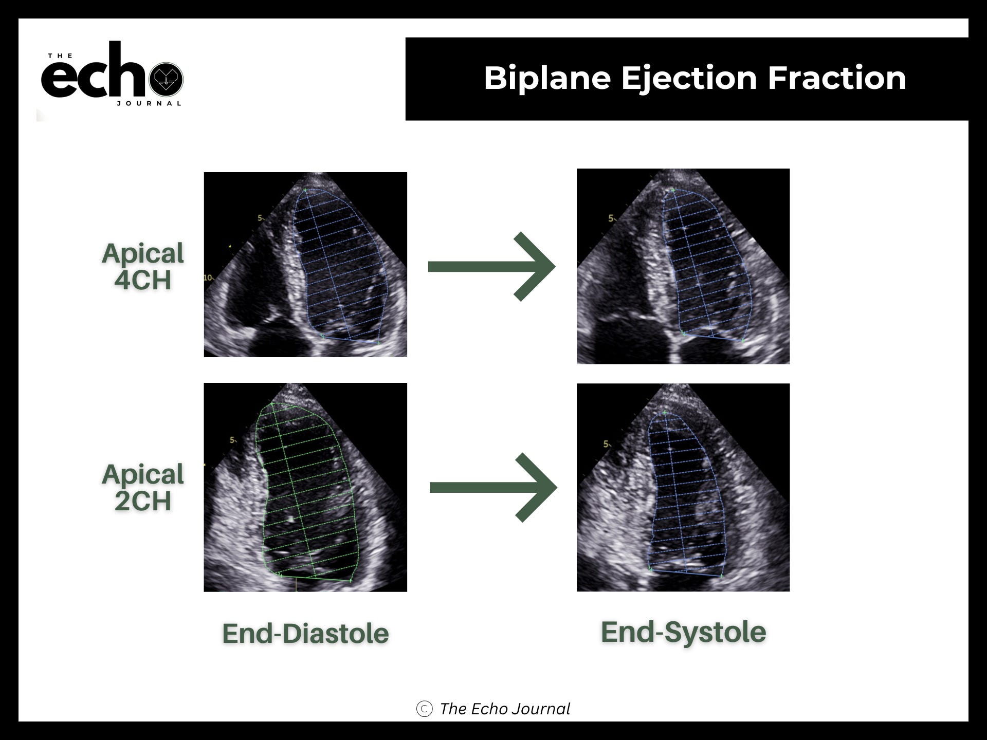 How To: Measure Simpson's Biplane Accurately - by Aram K.