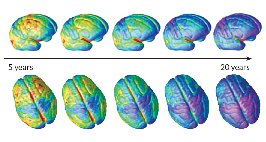 Mapping Stress in the Teenage Brain and How Neurons Communicate