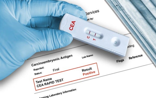 CEA Test (Carcinoembryonic Antigen) - by Survivor