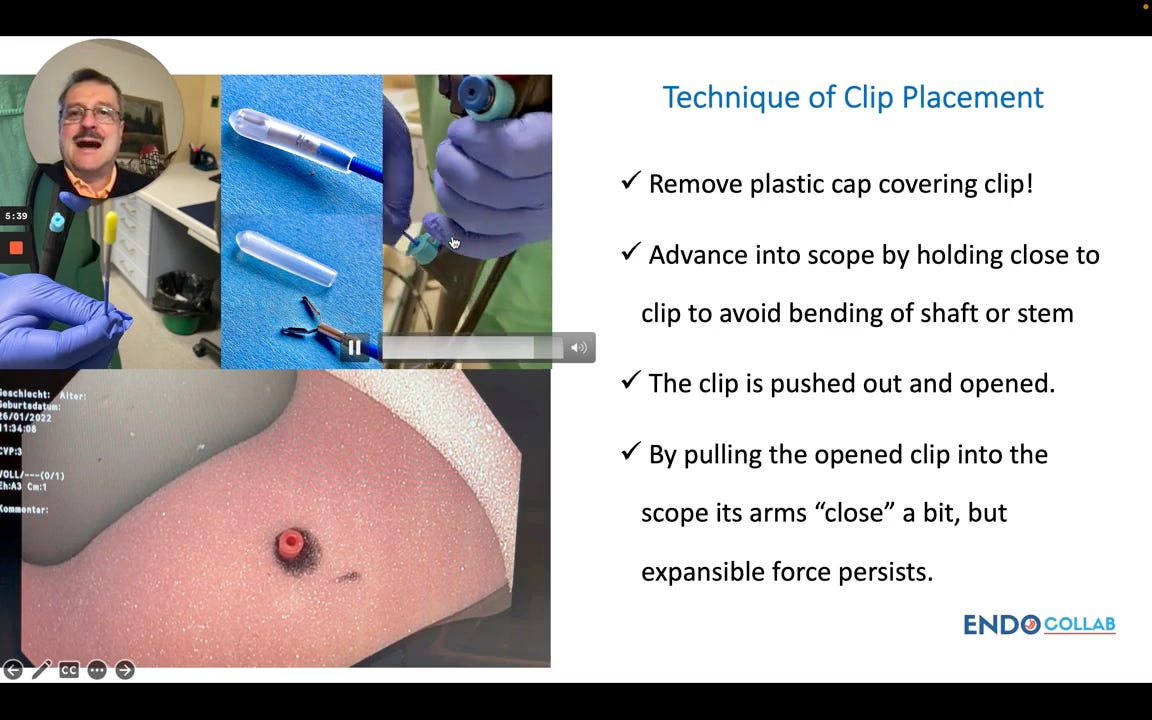 Mastering Hemostasis: Essential Techniques for Endoscopic Clip Placement