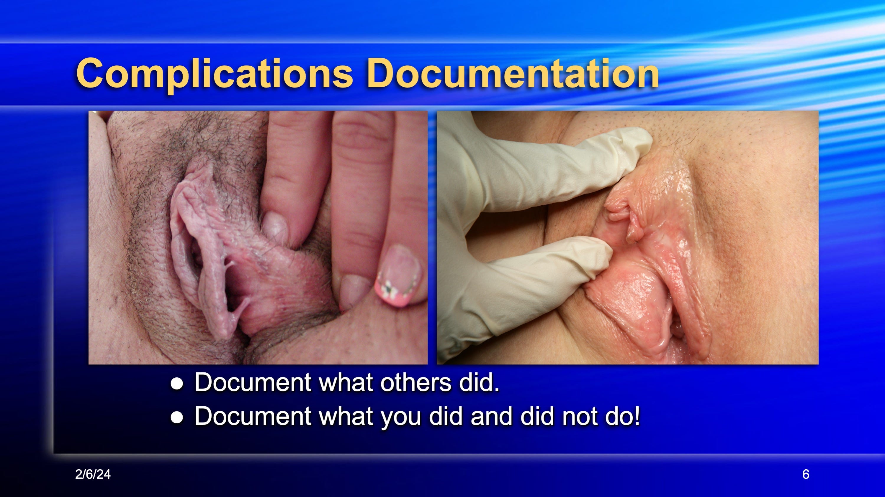 Gynecologic Photography for Dummies - by Red Alinsod, MD