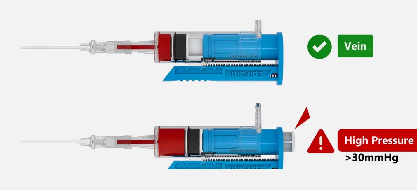 A new way to measure pressure during central venous access