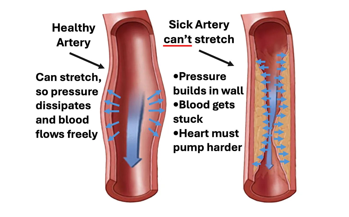 The Hidden Cost of Overmedicating Blood Pressure