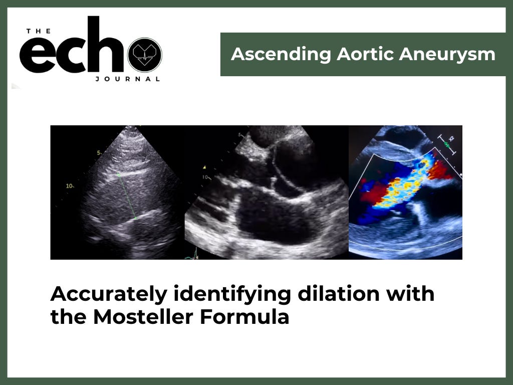 How to Index Ascending Aorta Size to Body Surface Area (BSA)