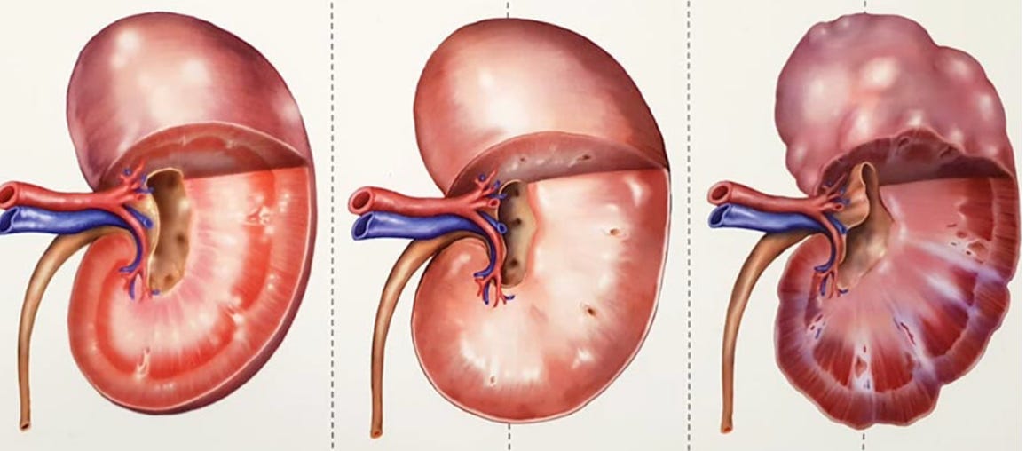 Enfermedad renal crónica en perros y gatos (I)