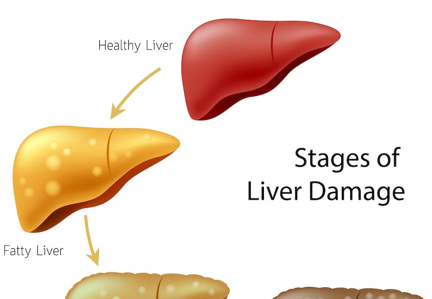 What causes Fatty Liver Disease - by Chris Hynes - cricket