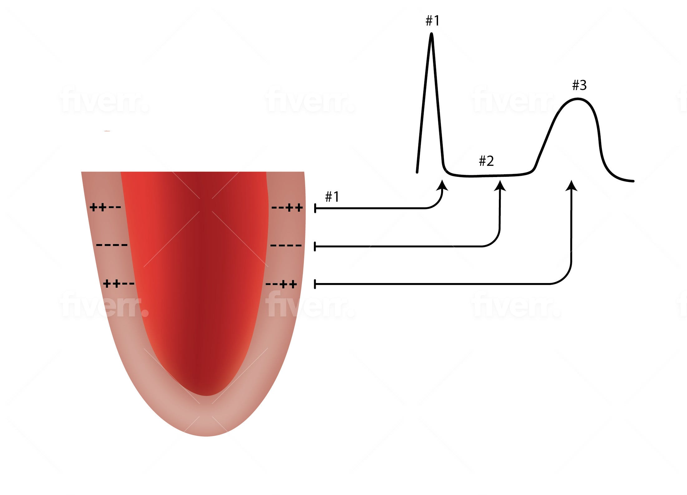 The R wave and T wave are Buddies