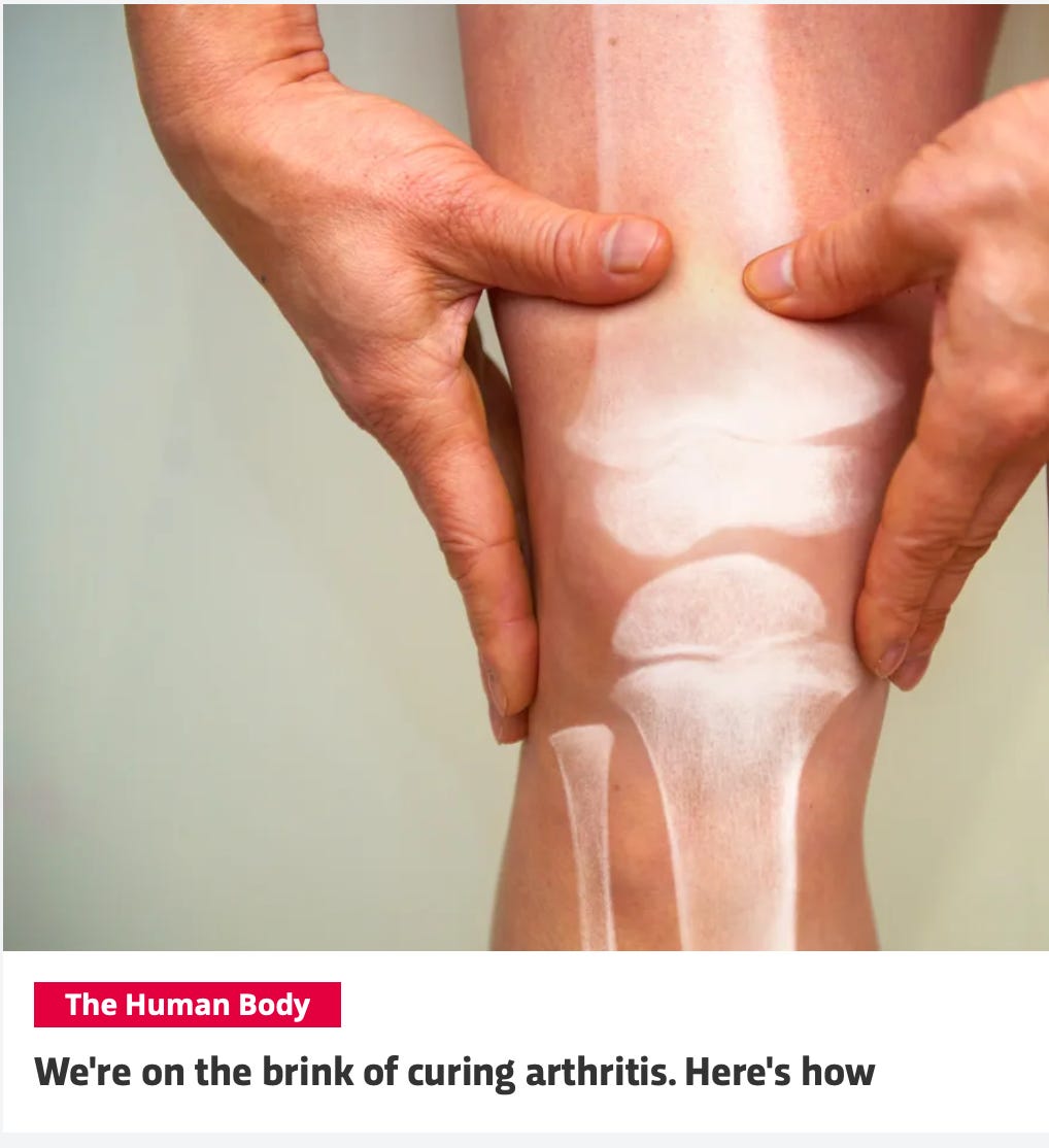 bad arthritis