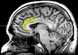 The Anterior Midcingulate Cortex: Your Brain's Discipline Center