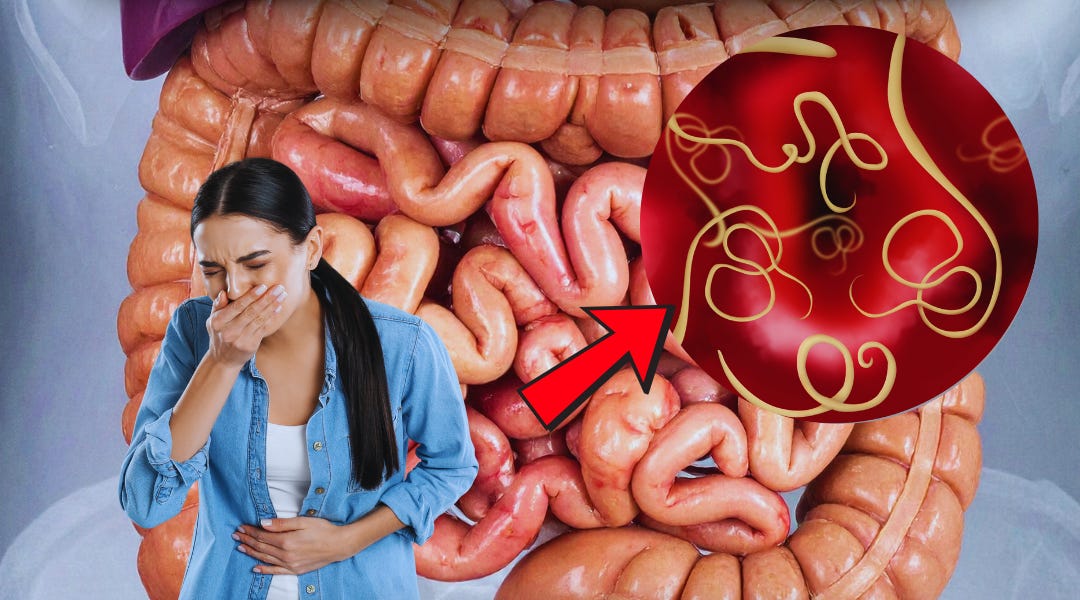 10 sintomas de vermes intestinais - Mais Saúde Blue