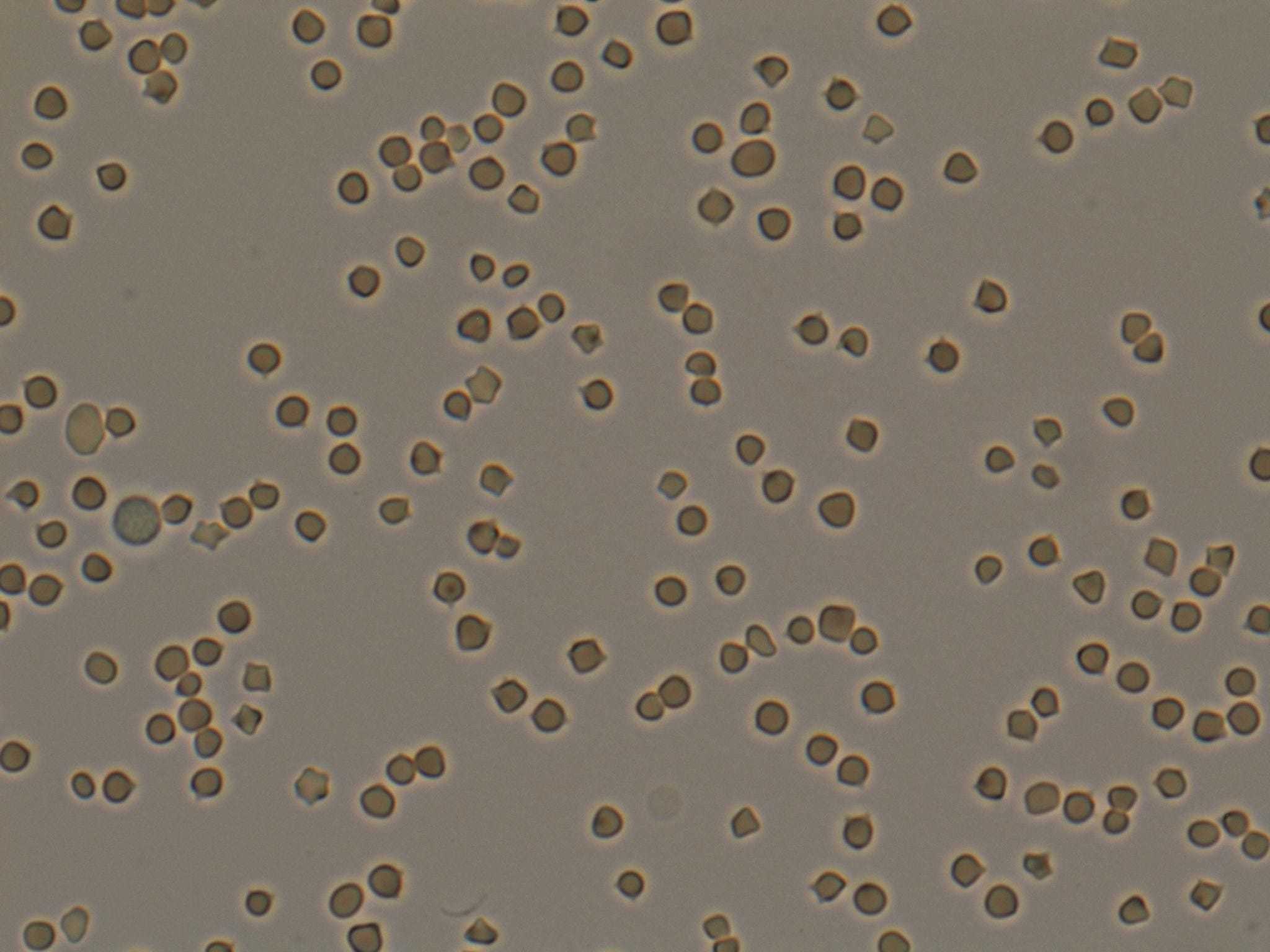 What's the Deal with the Saline "Agglutination" Test?