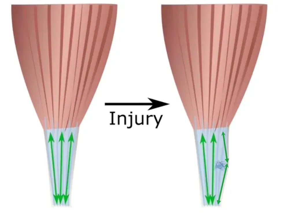 A Runner's Guide To Tendon Health (Part 1)