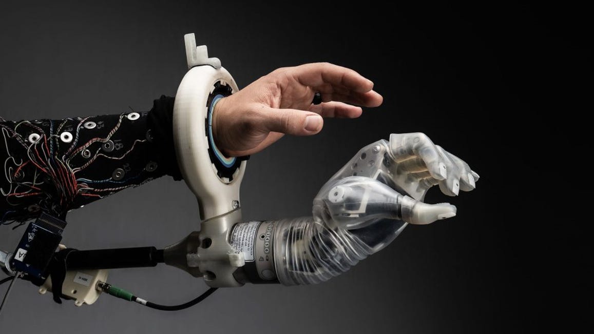 The Fascinating Future of Smart Prosthetics