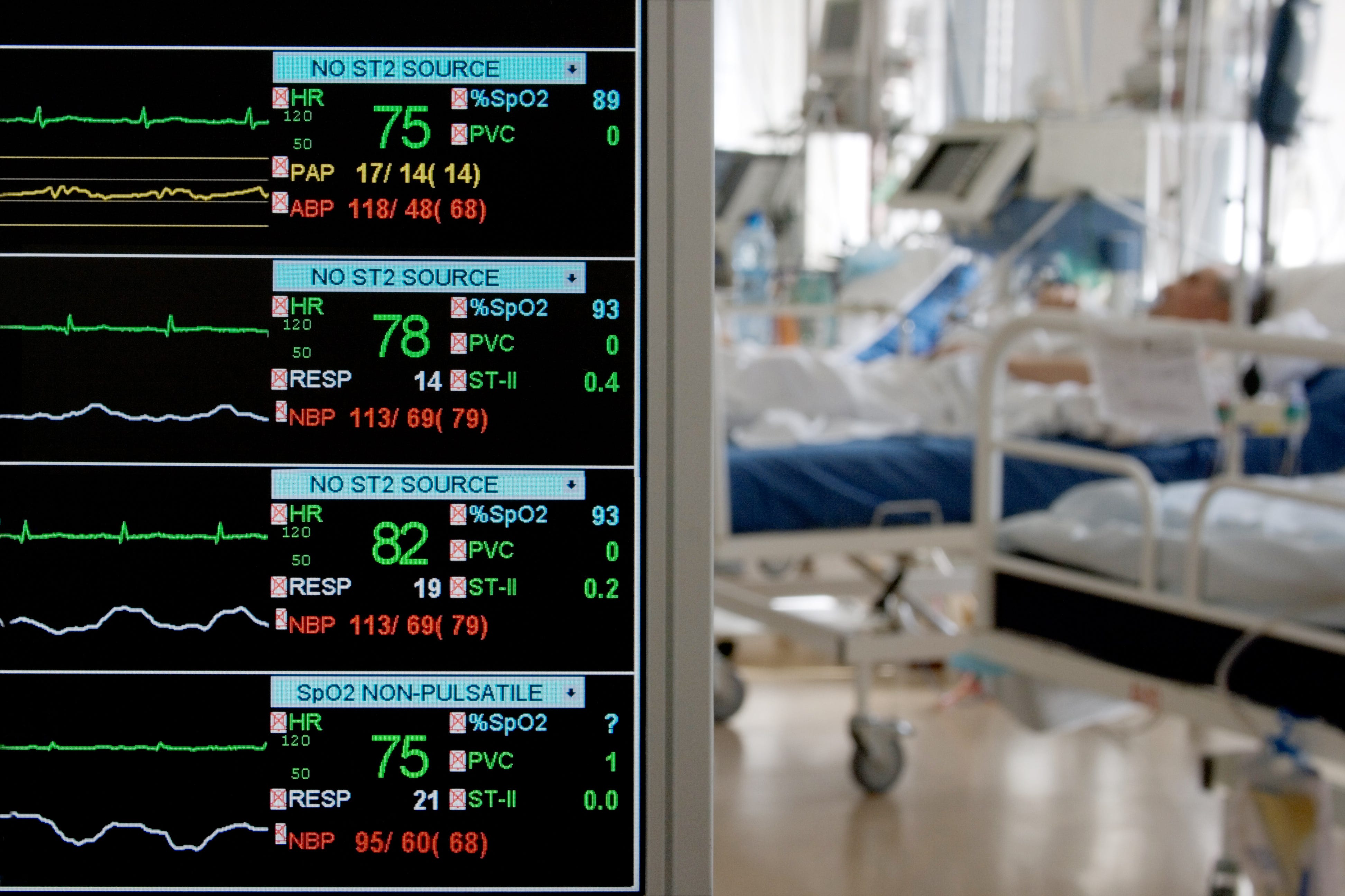 The new goal in goal-directed sepsis therapy: Pink pinkies