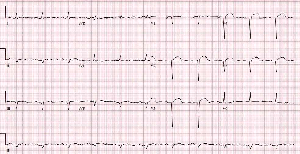 Having an old ECG helps your doctor help you