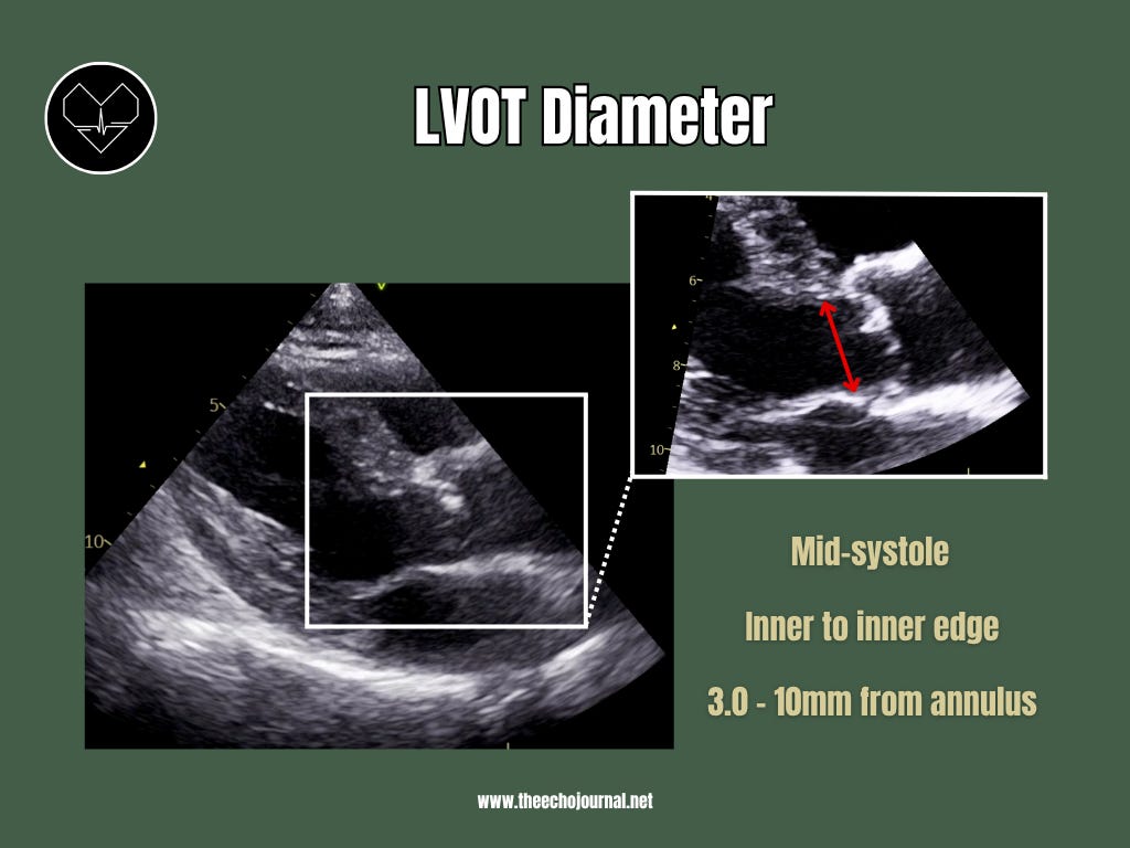 Aortic Stenosis: How to Calculate an AVA - by Aram K.