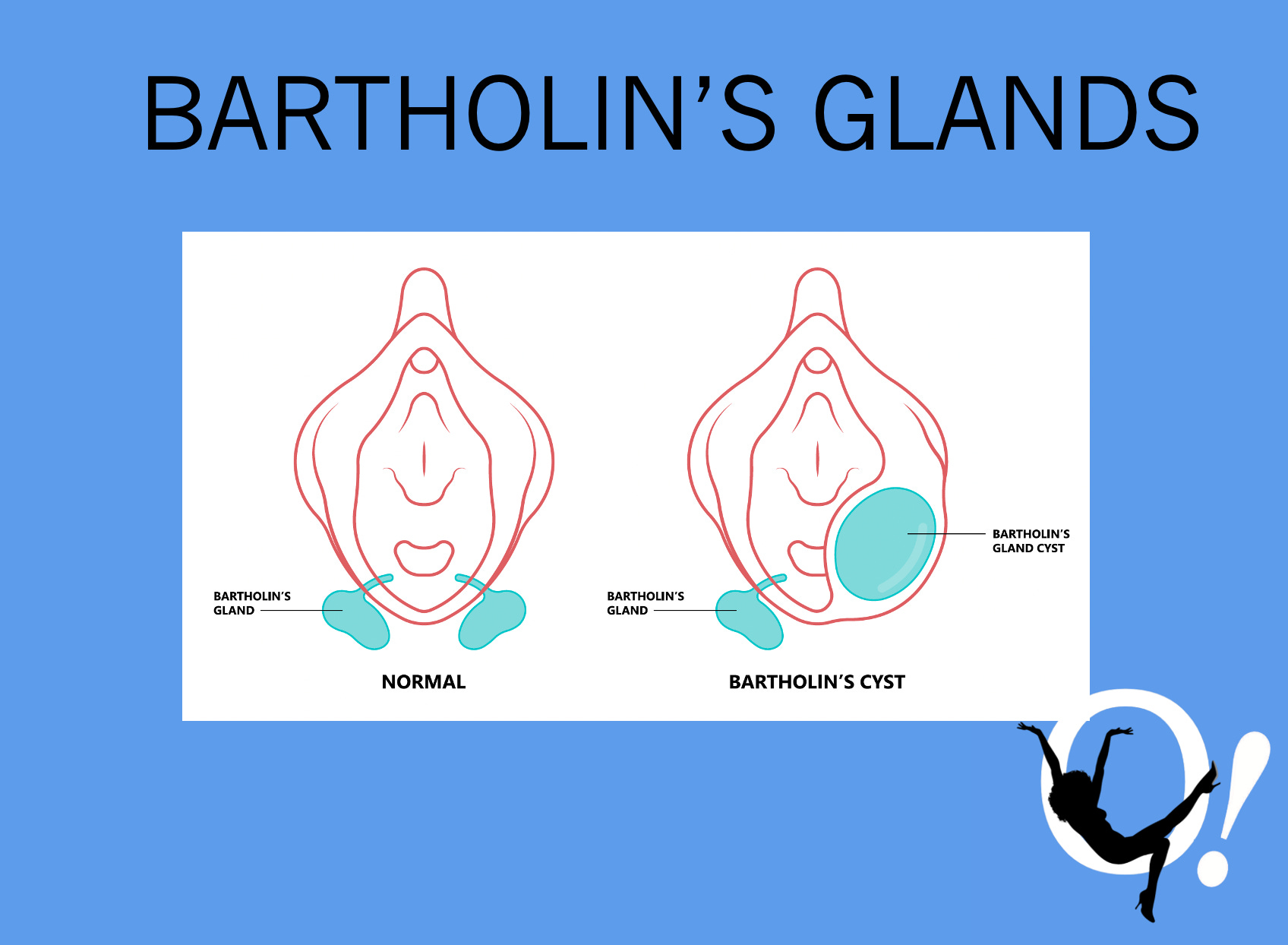 Female PELVIC and VULVAR ANATOMY - by Lauren Streicher MD