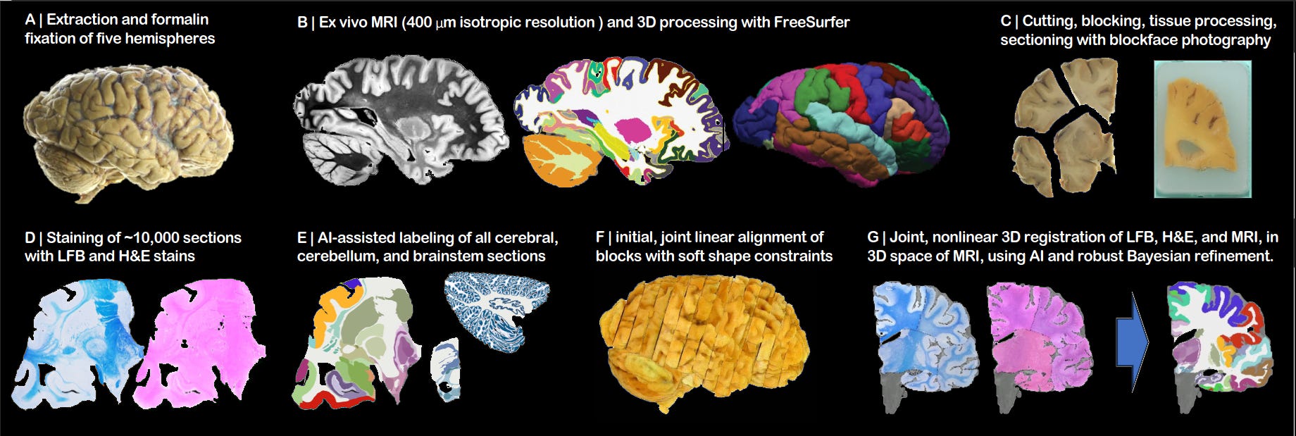 NextBrain: The Micro-Anatomical Shift That Finally Unlocks Precision ...
