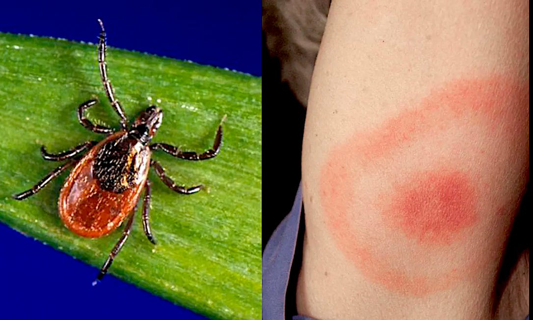 Plum Island, Bioweapons Lab 257, and Lyme Disease