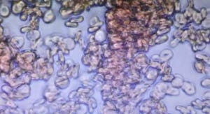 Understanding the Effects of Different Chlorine Dioxide Preparations on ...