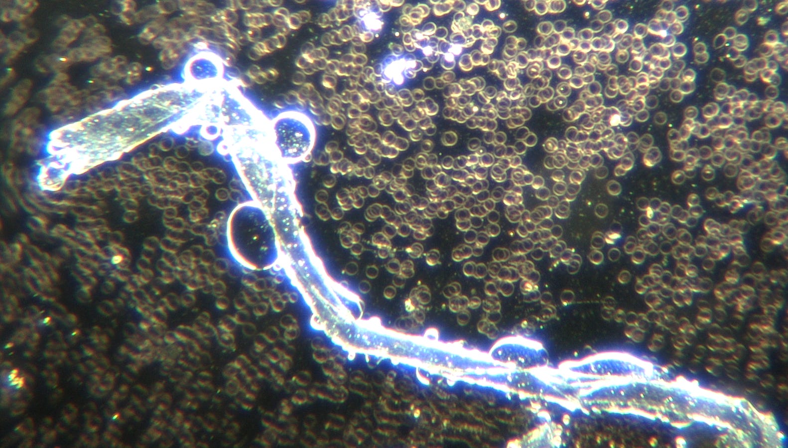 Darkfield Microscopy Shows Self Assembly Of Microfilament In C19 ...