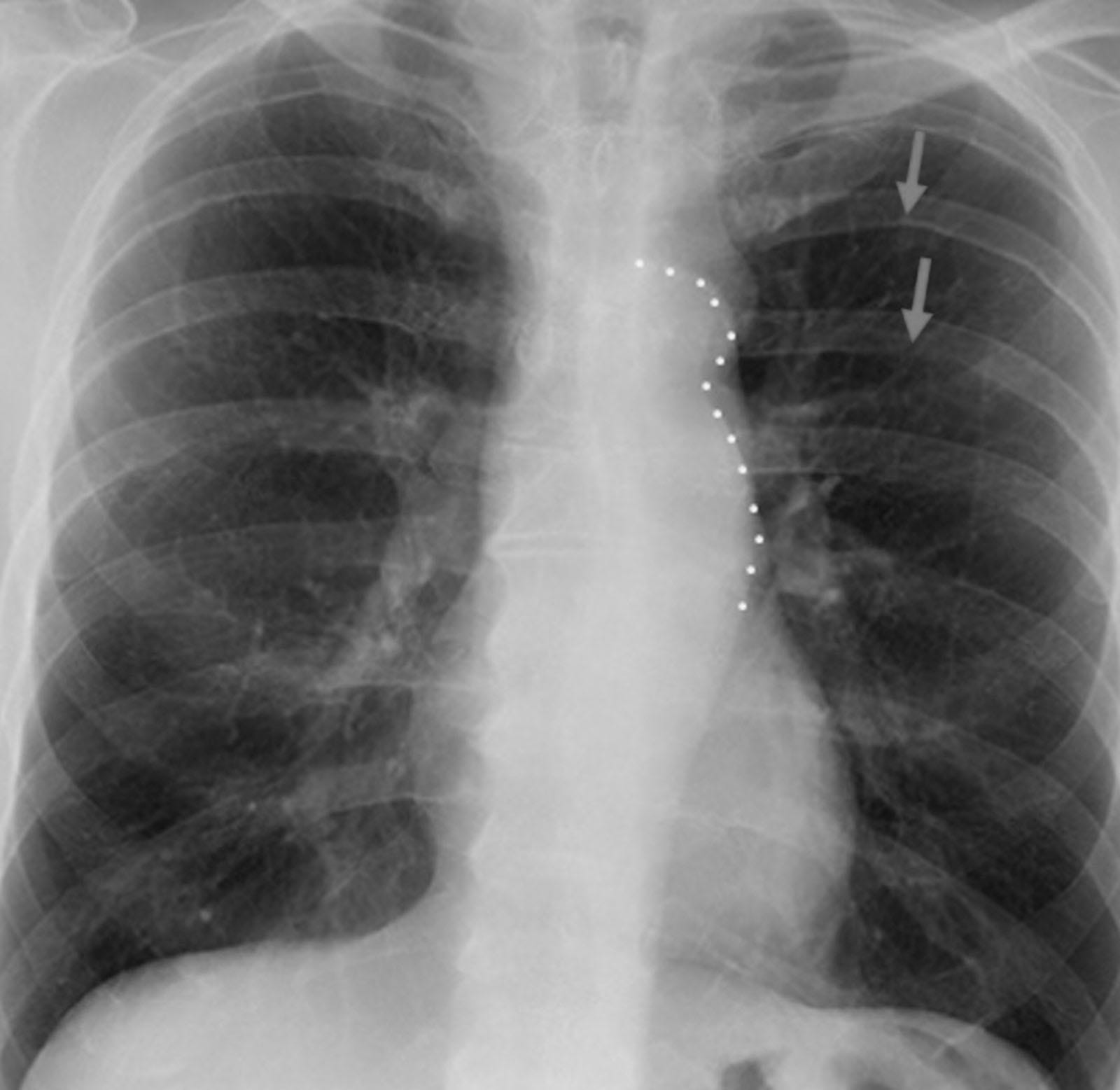 IM Reverse Board Review (3): Cardiology Imaging Clues