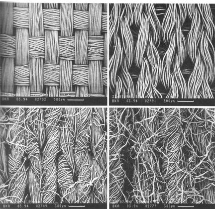 How Fibres Transfer and Why it Matters - by Tiernan Coyle