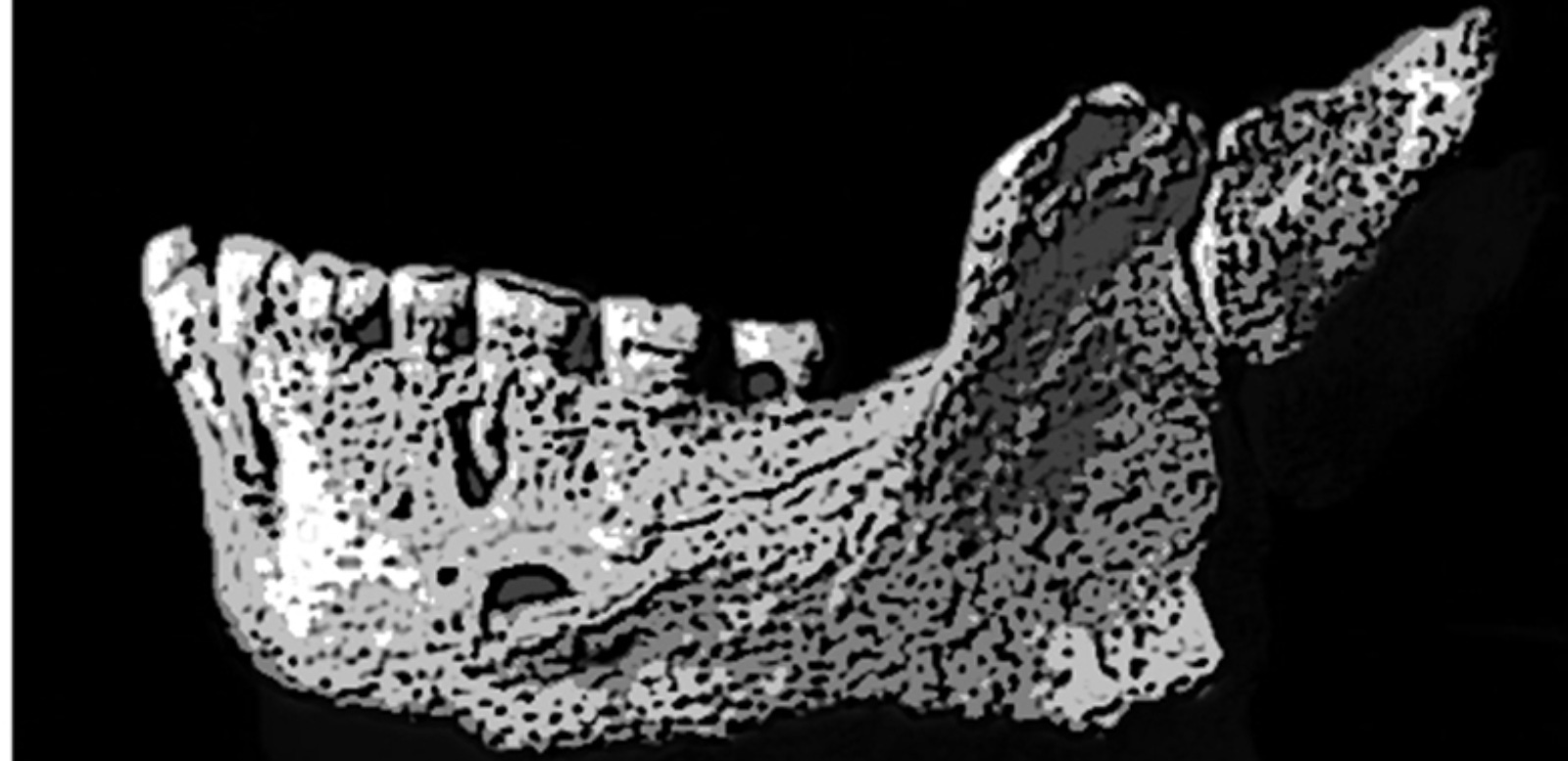 Did Neanderthals Use Medicine? - by Cassandra Quave