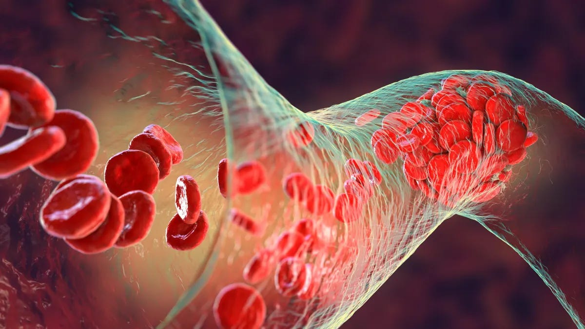 Nattokinase: Breaking Down Blood Clots Induced by Spike Protein