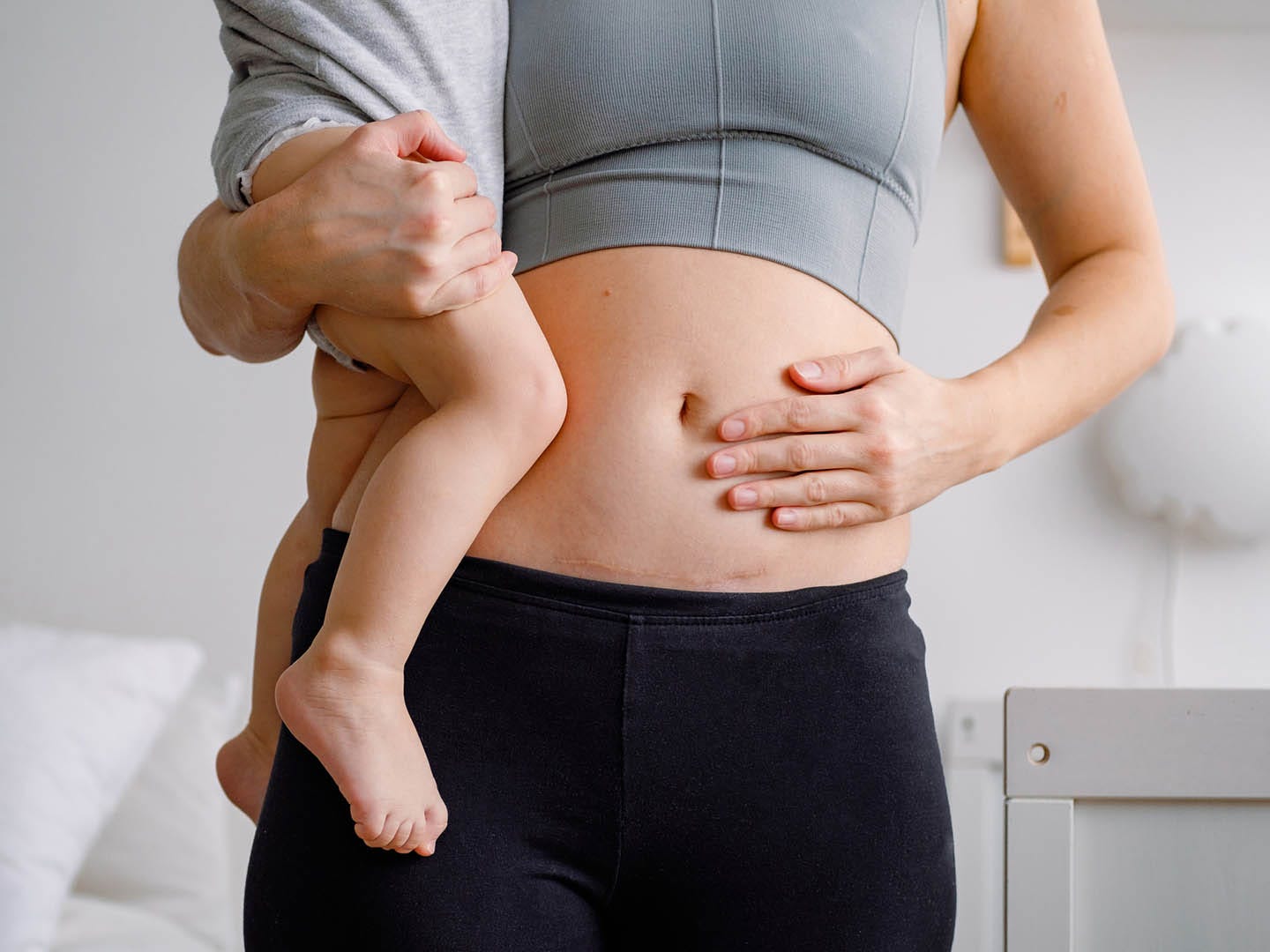 C-Section and Gut Health - Weil Nutrition Corner