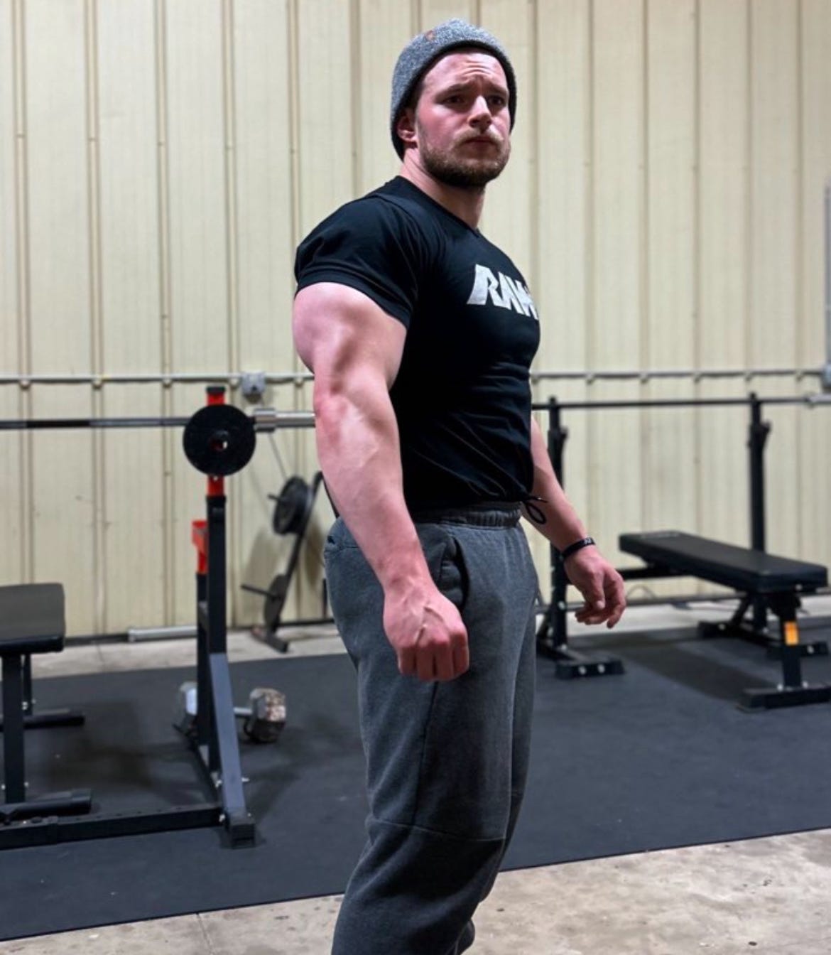 Why Your Triceps Are Still Weak (Even Though You Train Them Like Crazy)