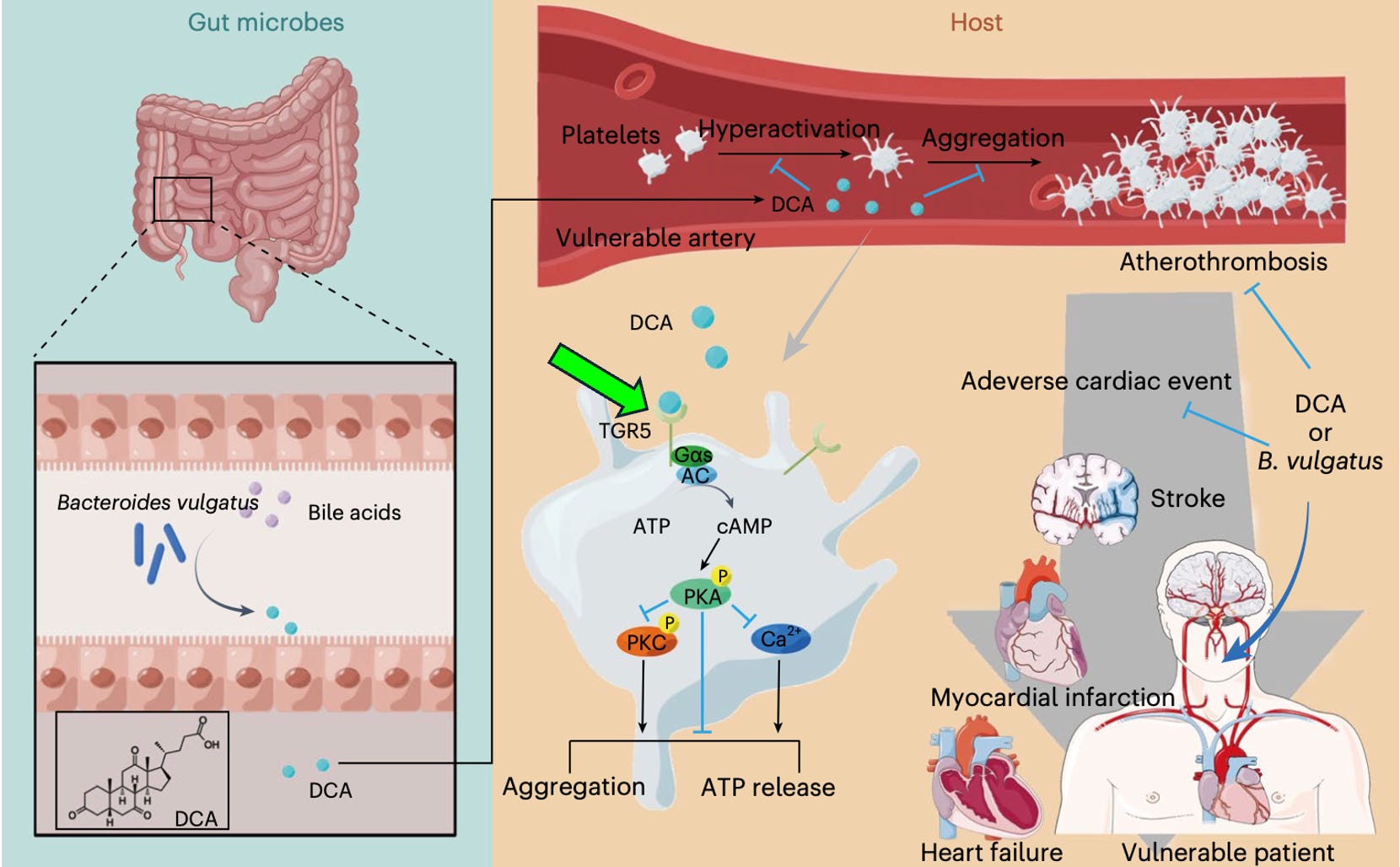 This Simple Gut Molecule Could Protect Against a Heart Attack