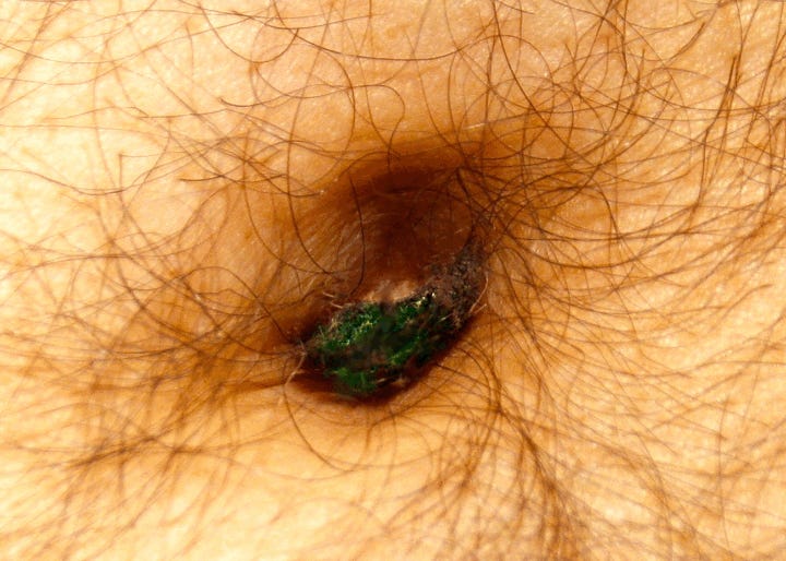 belly button lint hard