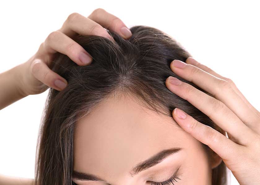 How to Fix Hidden Nutrient Gaps That Trigger Hair Loss