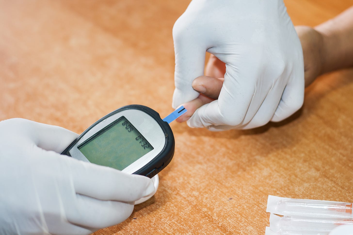 SCCM Releases 2024 Guidelines for Hyperglycemia in the ICU