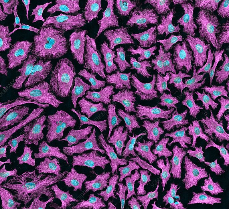 Henrietta Lacks' Stolen Cells Built Modern Medicine While She Died in ...