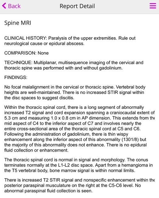 Kayla Pollock: Part One - by Dr Mark Trozzi MD - Dr Trozzi