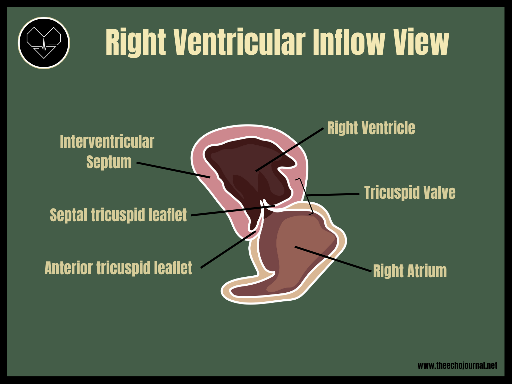 Tricuspid Leaflets Made Simple - The Echo Journal